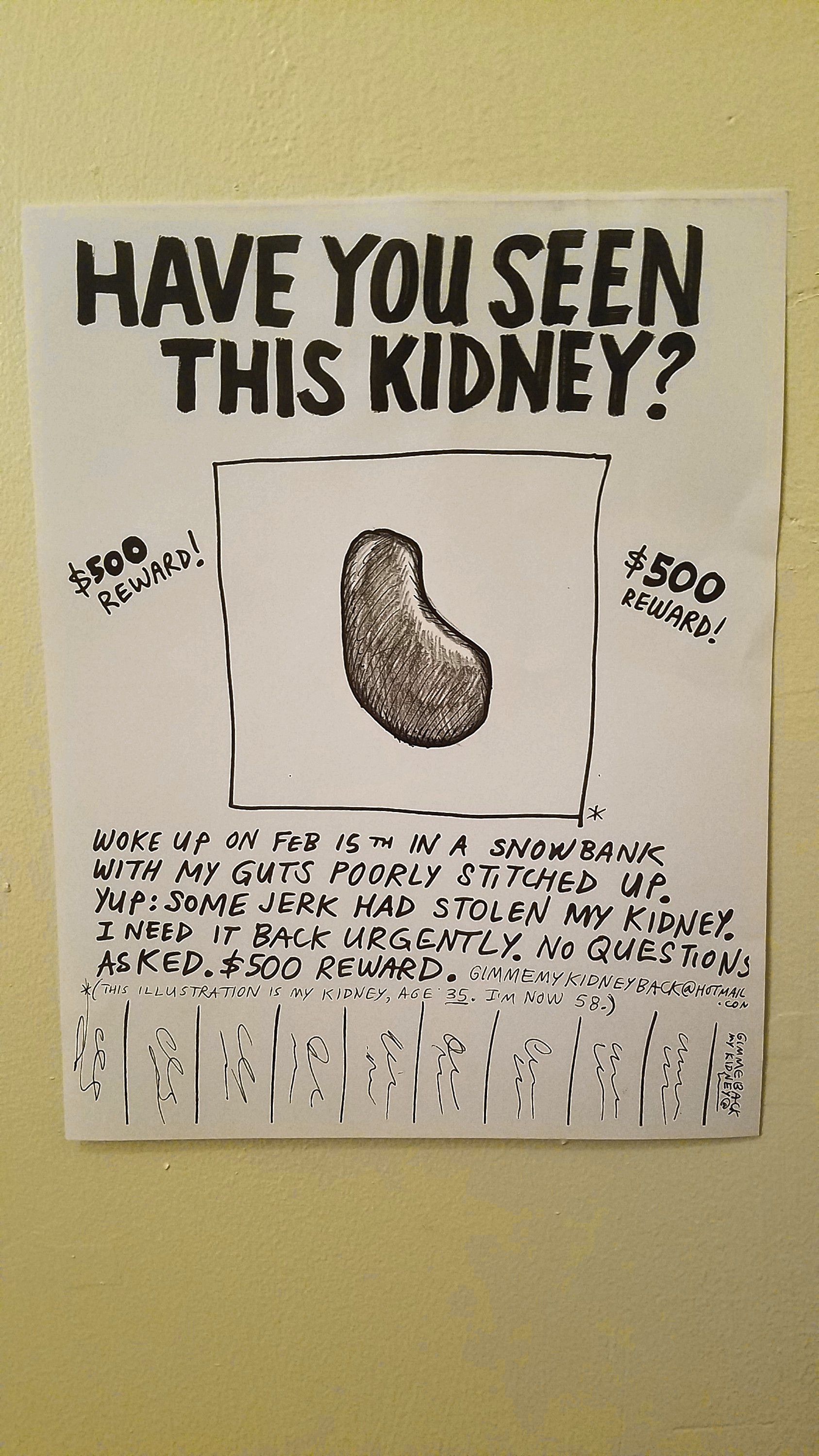 Around Town: Missing kidney poster spotted in True Brew bathroom - The ...